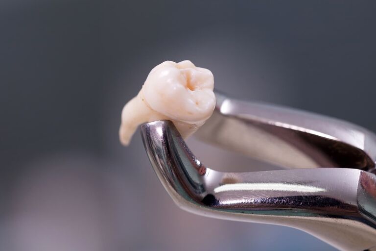Crown Dental Care | NHS Dental Treatments