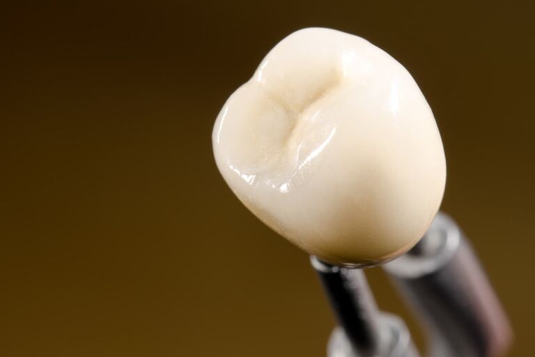 Crown Dental Care | NHS Dental Treatments